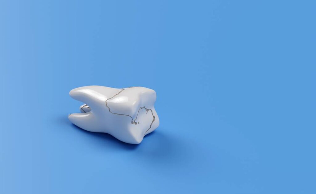 Top 7 Options for Fixing a Broken Tooth - Shodhan Dentistry - Blog
